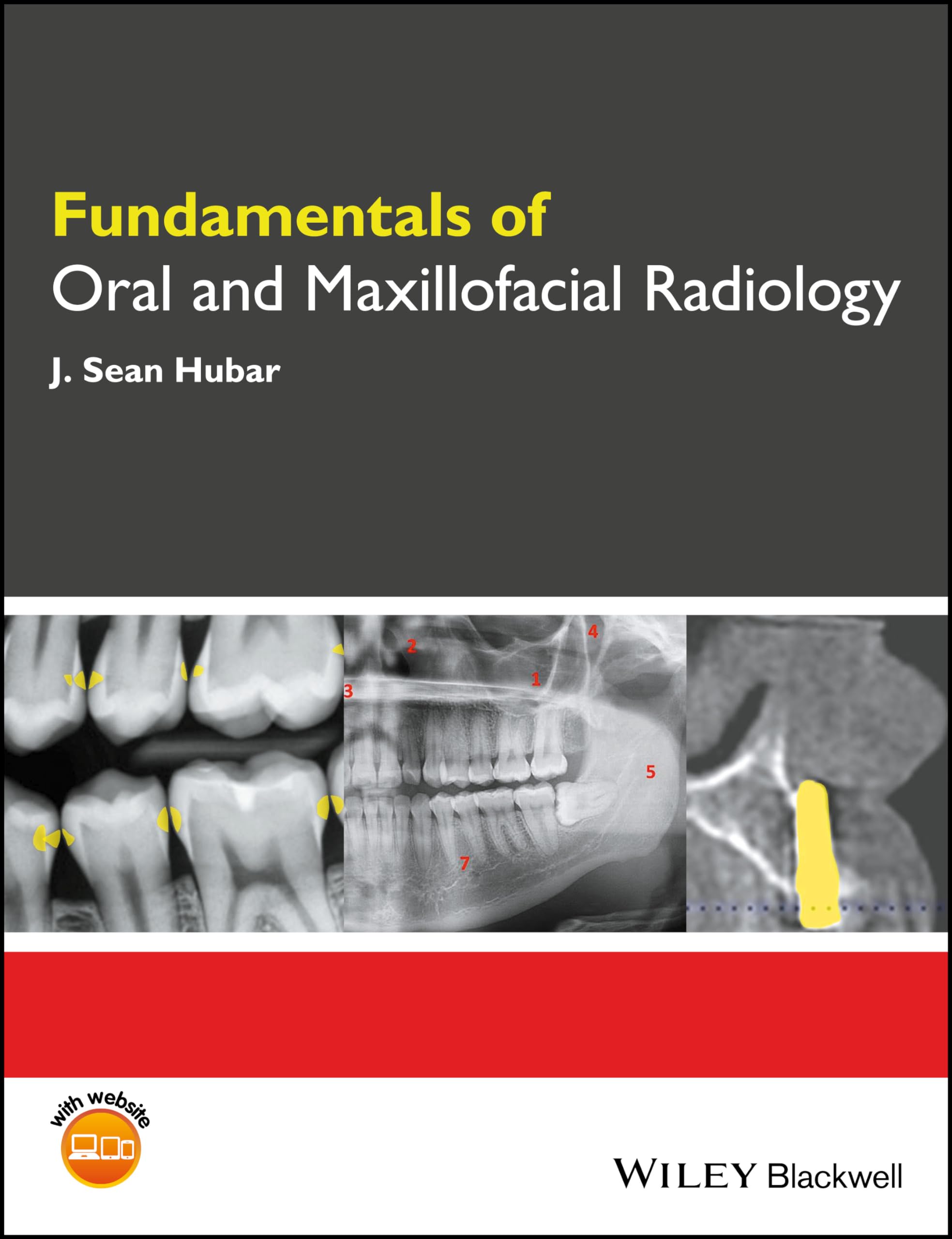 Fundamentals of Oral and Maxillofacial Radiology (Fundamentals (Dentistry))