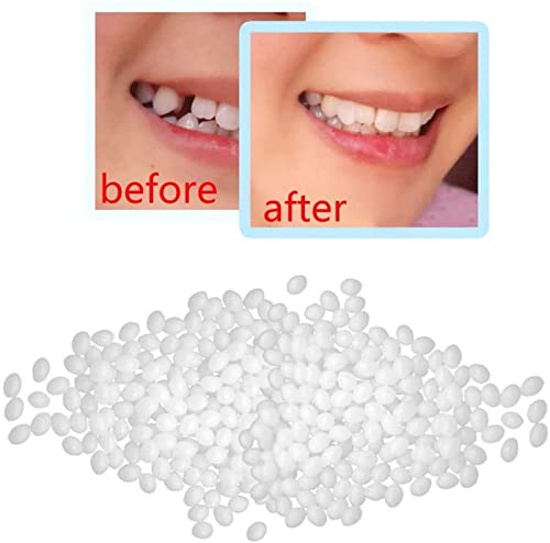 Decorative Denture Cup with For And Solid Tooth Make Glue Denture Teeth (30g) FalseTeeth Temporary Adhesive Confidently Tooth Missing Teeth Gaps Kit Denture Clip on Braces for Looks