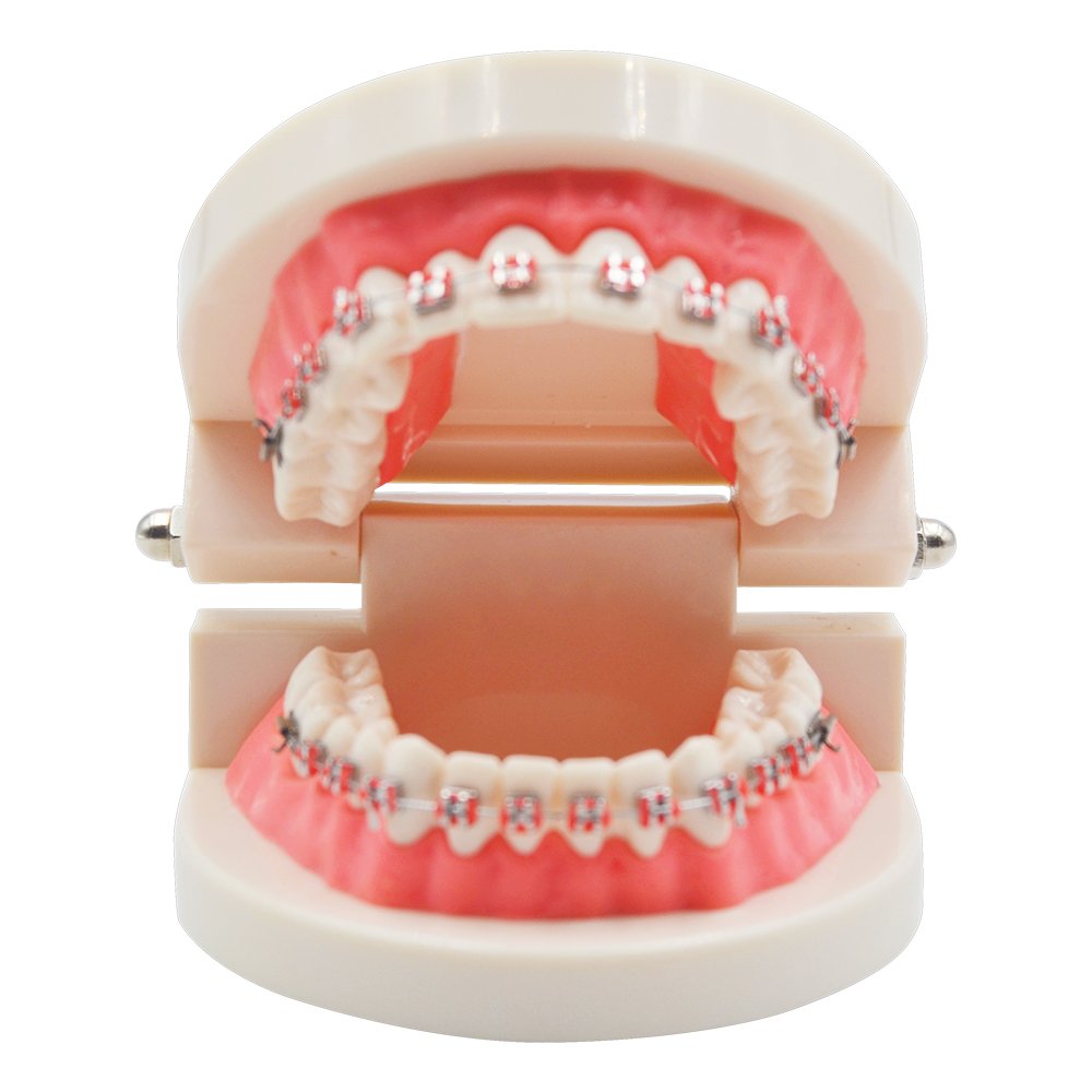 COSPNT Orthodontic Treatment Model Standard Teaching Model Study Teeth Educational Demonstration Tool Student forTeaching All Metal Brackets