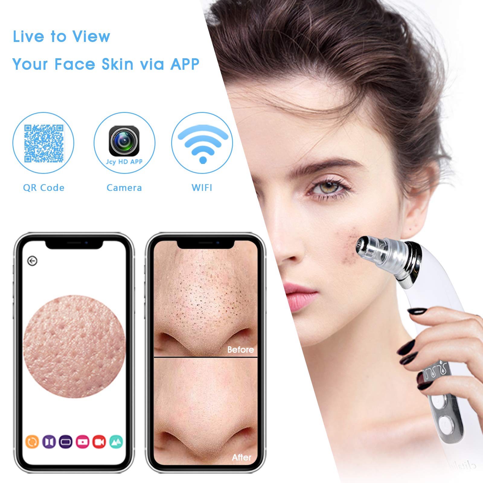 Blackhead Remover with Camera, Upgraded Pore Vacuum Cleaner, Visible Whitehead Remover Tool Pimple Blemish Acne Extractor Kit with 5 Replaceable Probes,20X Microscope,6 LED Lights - For Women Men Skin