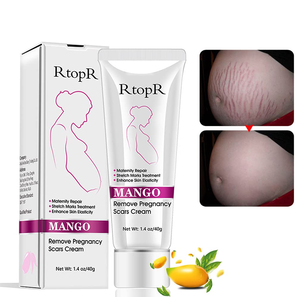 Cream Scar Removal for Pregnancy