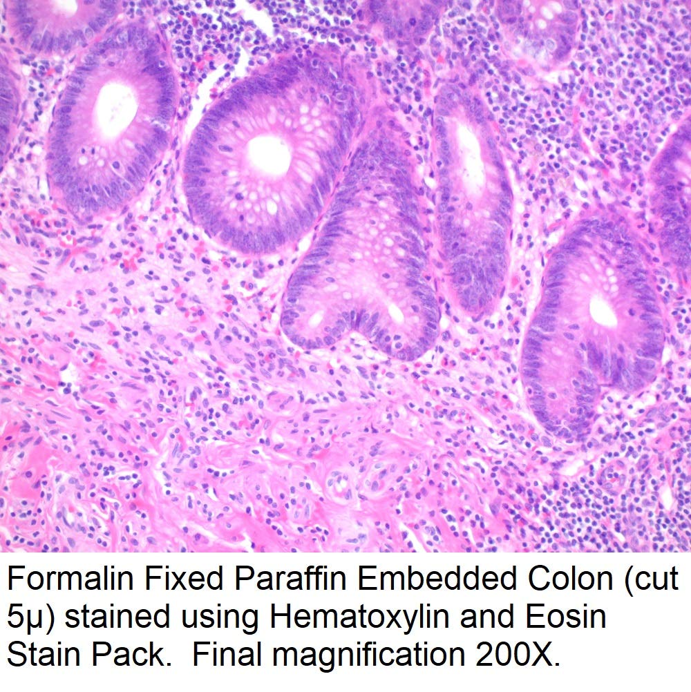 Hematoxylin and Eosin Stain Pack, 1000ml