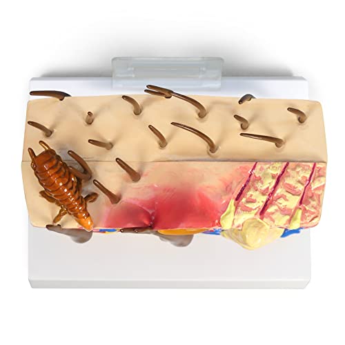 GPI Anatomicals - Canine Skin Model, Skin Model with Flea Bite for Canine Anatomy and Physiology Education, Anatomy Model for Veterinarianās Office and Classrooms, Medical Study Supplies