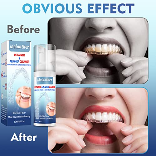 Melanther Retainer Cleaner with Toothbrush - Braces/Aligner Cleaner Whitening Foam for ClearCorrect, Essix, Vivera & Hawley Trays/Aligners, Denture Cleaner & Fights Bad Breath (60 ml)