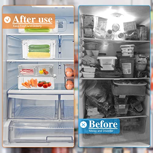 Modern-Depo 7 PCS Refrigerator Organizer Bins with Lids Food Containers with Various Size Stackable Storage Bins for Fridge, Countertop, Cabinets & Pantry