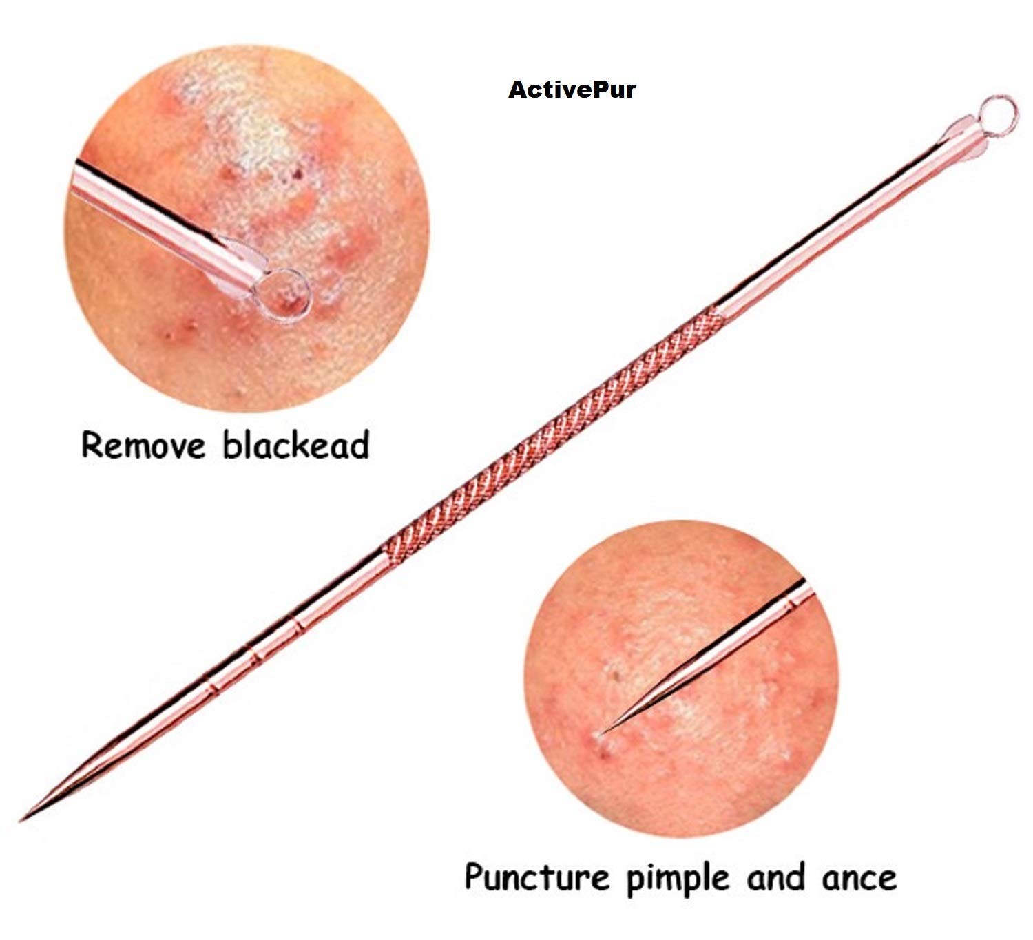 Blackhead Remover Pimple Comedone Extractor Tool, Effective Acne Removal Kit, Treatment for Blemish, Whitehead Pimple Popping, Zit Removing for Nose & Face Skin, Best Electroplated 4 PCS w/case.