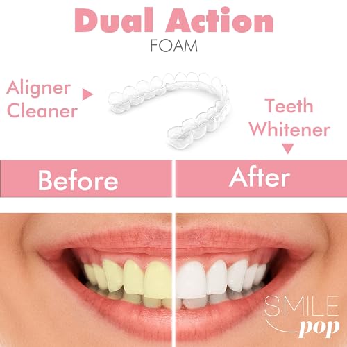 Smile Pop Mint Aligner Cleaner & Whitener Foam for Invisalign Cleaner, Dentures and Essix Trays. Retainer Cleaner Contains Hydrogen Peroxide, Fights against Bad Breath, Brightens teeth and Kills Germs