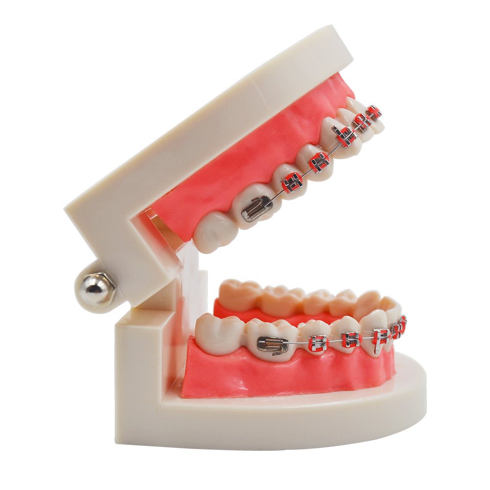 COSPNT Orthodontic Treatment Model Standard Teaching Model Study Teeth Educational Demonstration Tool Student forTeaching All Metal Brackets
