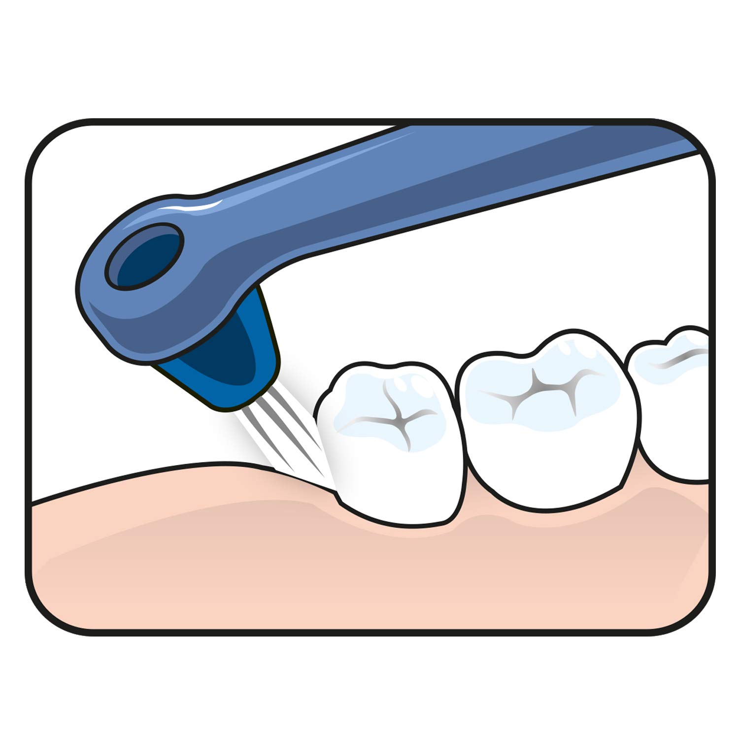 TEPE Interspace Angled Medium Toothbrush for Braces with Single-End Tuft and Removable Head, 12 Pack