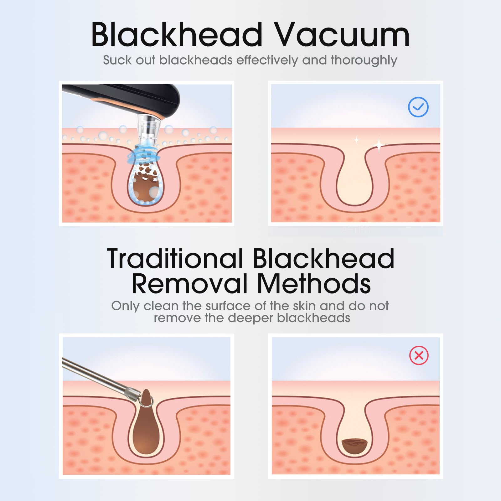 Blackhead Remover Vacuum Yccu Professional Pimple Popper Tool Pore Vacuum Black Head Remover for Face USB Rechargeable Blackhead Extractor for Removing Blackhead Whitehead Acne