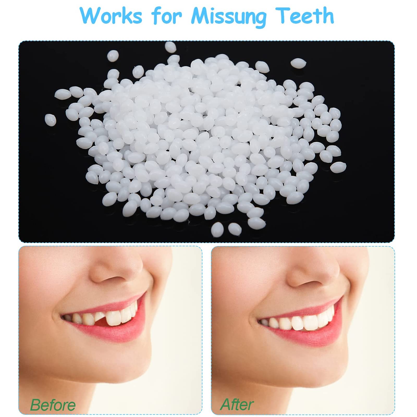 CAILING 4 PCS Professional Tooth Replacement Kit, DIY Denture Kit for Cosmetic Teeth, Natural Shade Fake Veneer for Temporary Fix Confident Smile