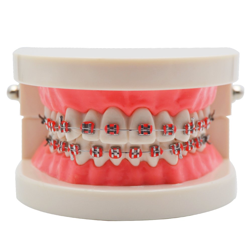 COSPNT Orthodontic Treatment Model Standard Teaching Model Study Teeth Educational Demonstration Tool Student forTeaching All Metal Brackets