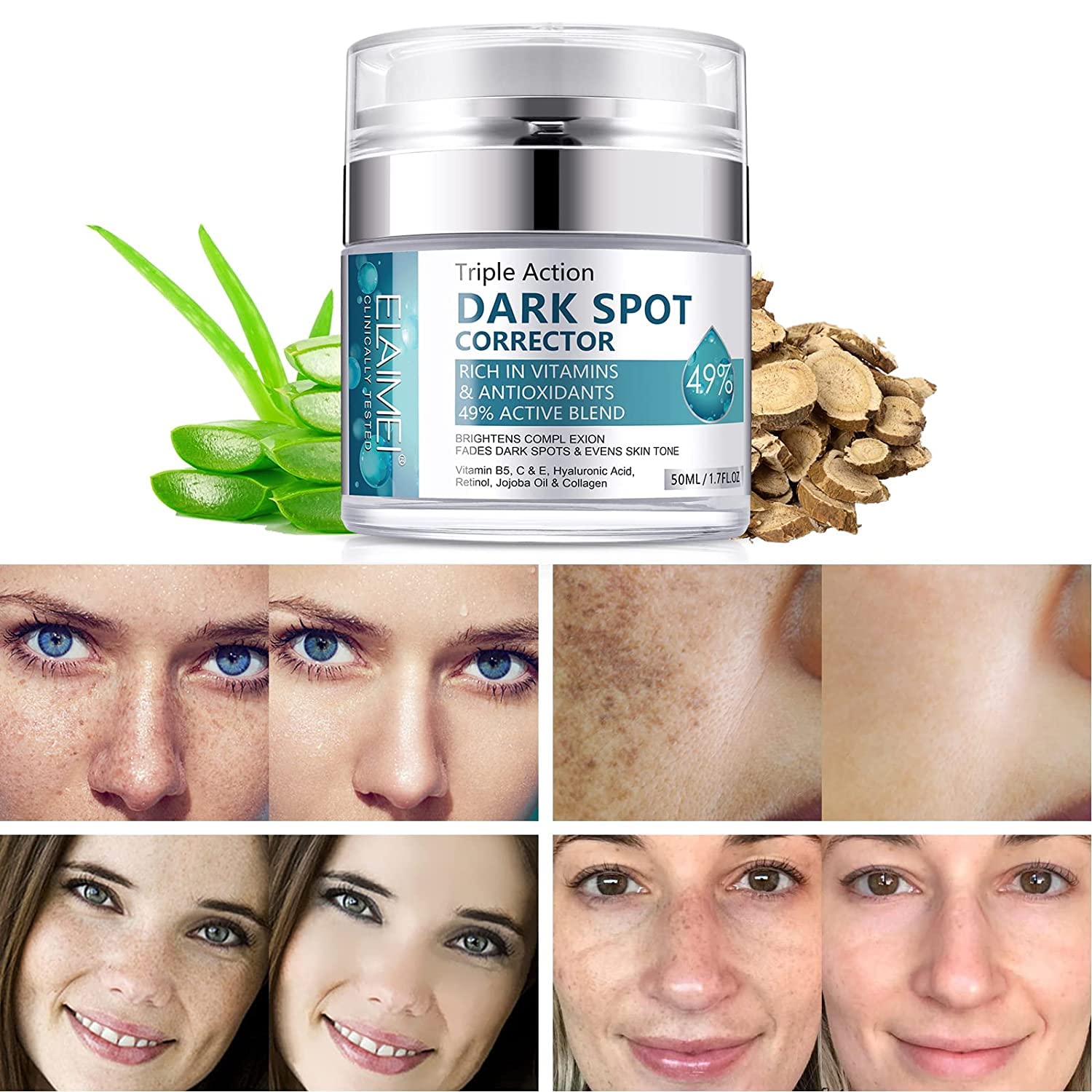 DABIUSY Dark Spot Remover for Face, Dark Spot Corrector, Hyperpigmentation Treatment, Sun Spot, Melasma, Freckle Remover, Natural Skincare for All Underarms, Elbows & Privates - 1.7 FL OZ (A)