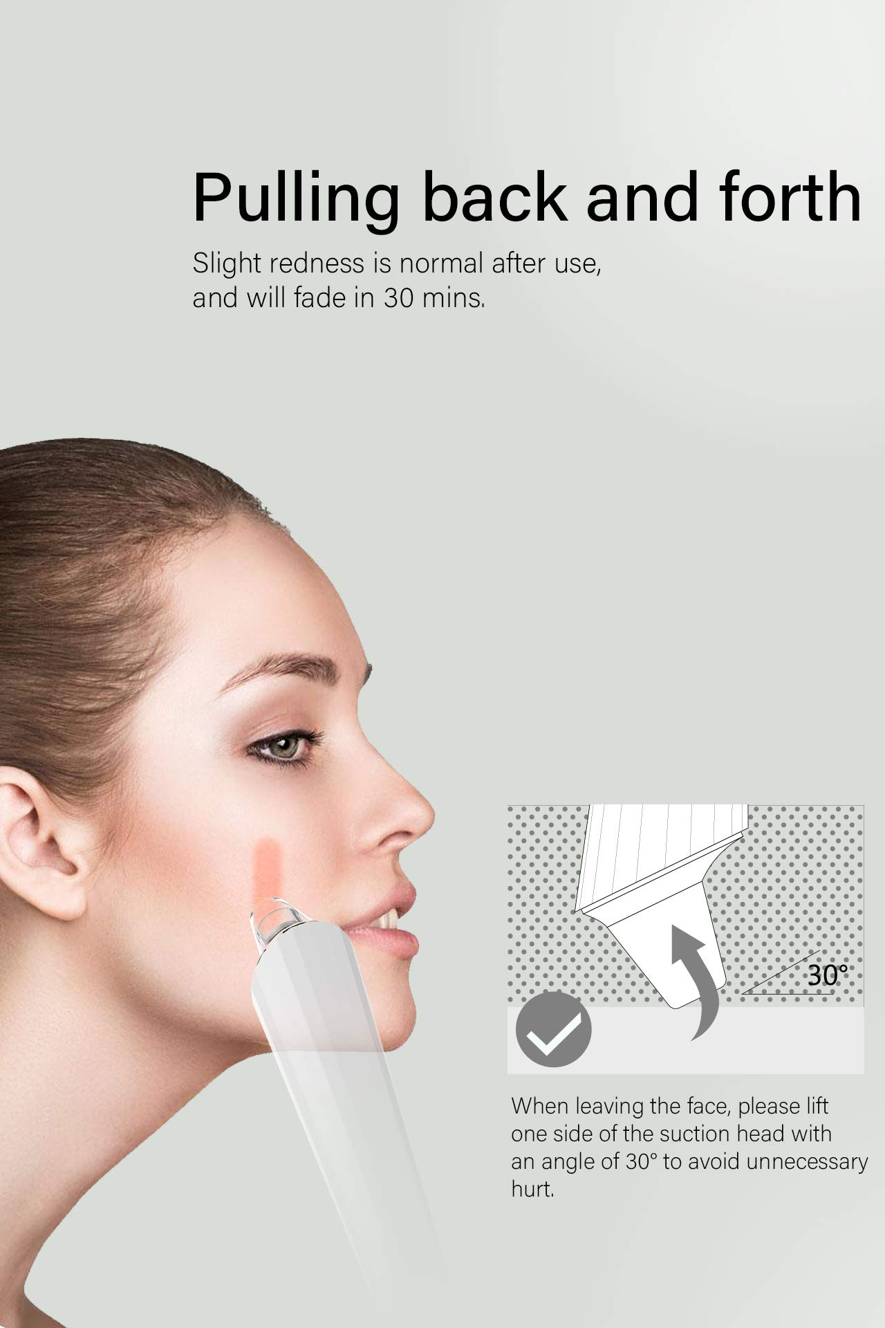 Blackhead Remover Pore Vacuum Cleaner Acne Comedo Extractor USB Rechargeable Blackhead Suction Tool with 4 Probes and 3 Adjustable Suction Level for Blackhead Whitehead Acne Removal