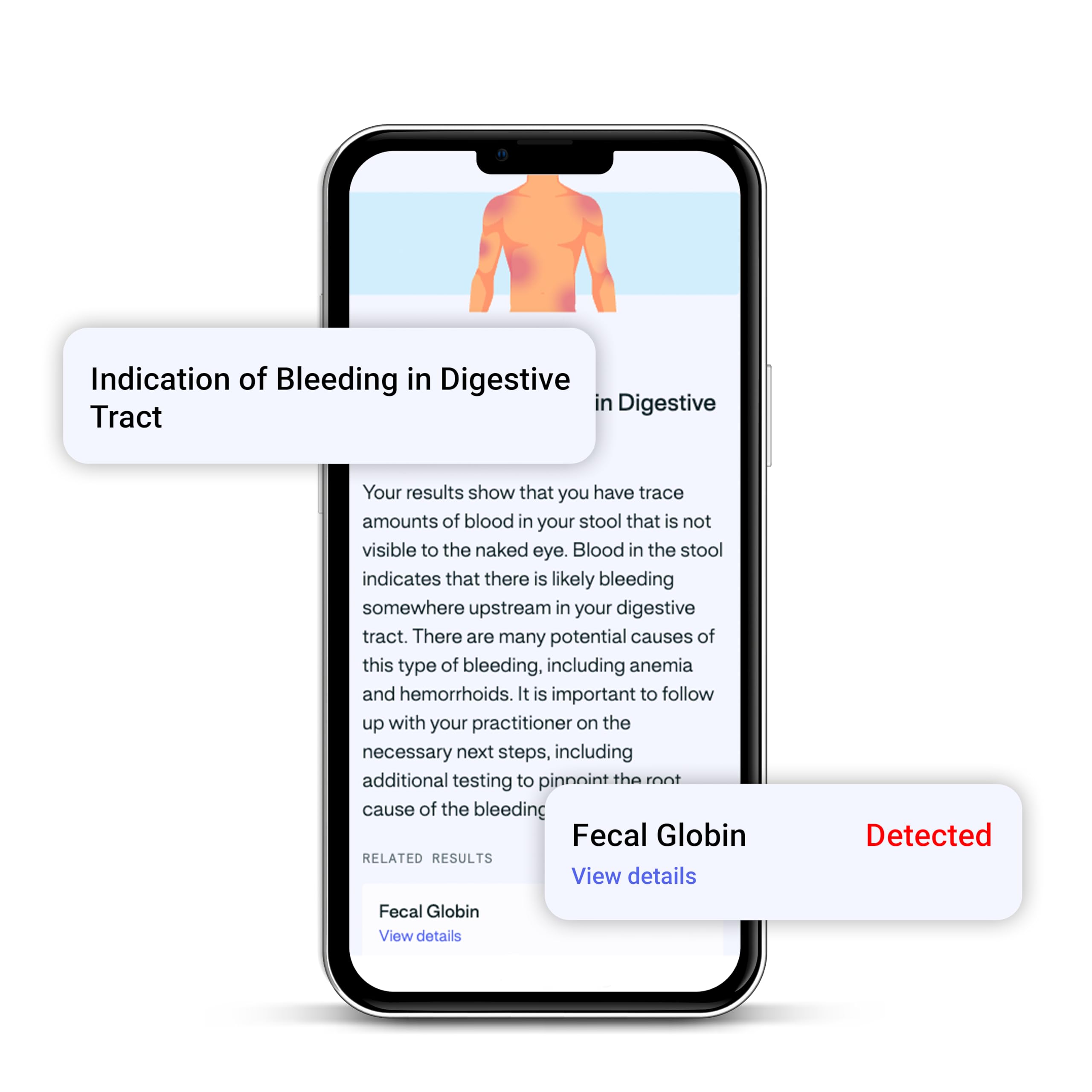 eFunctional Colon Cancer Screening Test: Easy at Home Use, Advanced Accurate Detection Technology, Private & Comfortable, Early Detection Advantage