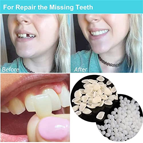 Cleaning Solution Temporary Tooth Kit For Filling The Missing Broken Tooth And Gaps Moldable Temporary Crown Veneers Material Anterior Front Back Molar Teeth Temporary Tooth Filler
