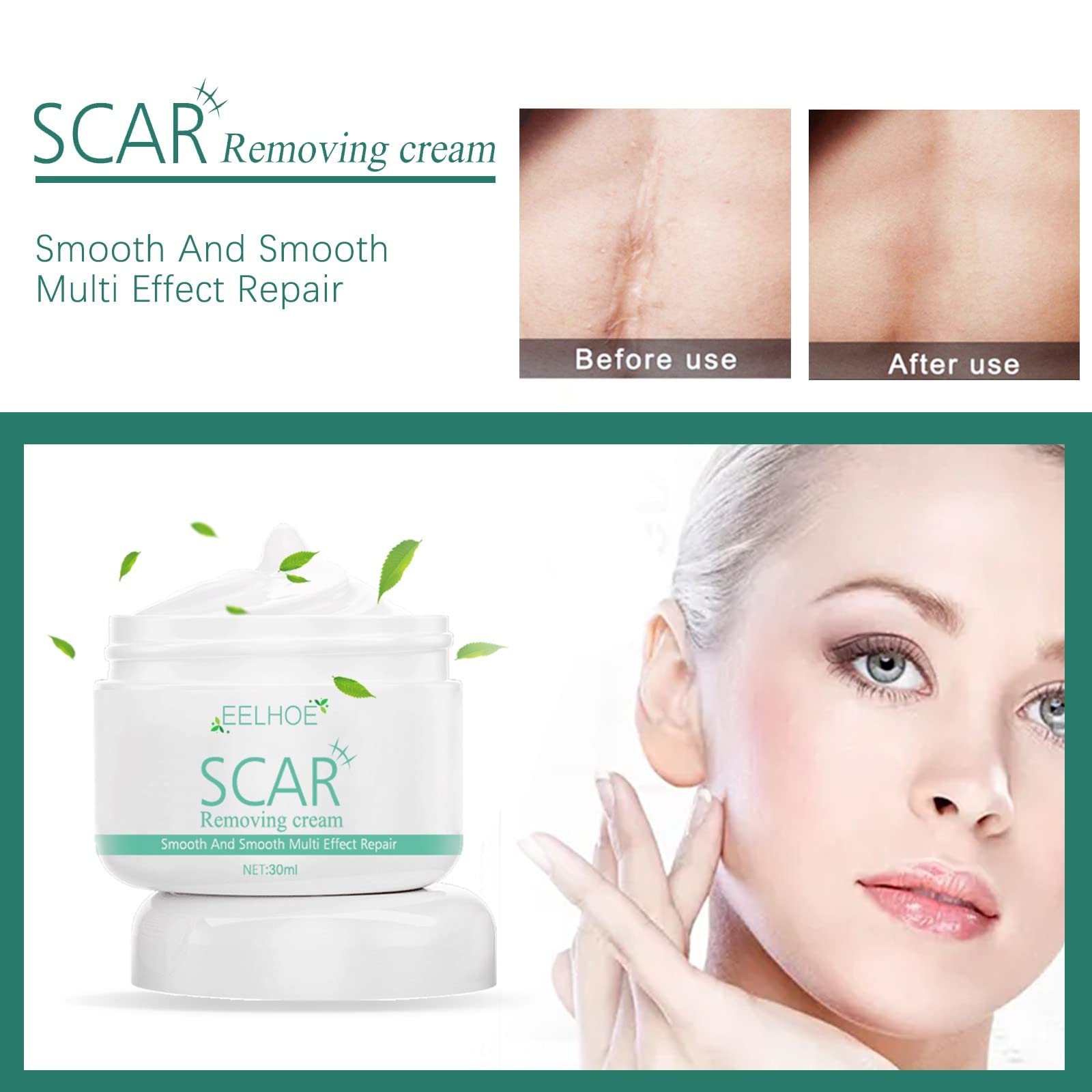 for Cooking Scar Removal Scar For Old Stretch Mark Removal For Men Women Stretch Marks And Burns Face Skin Volcanic Stone Face Roller