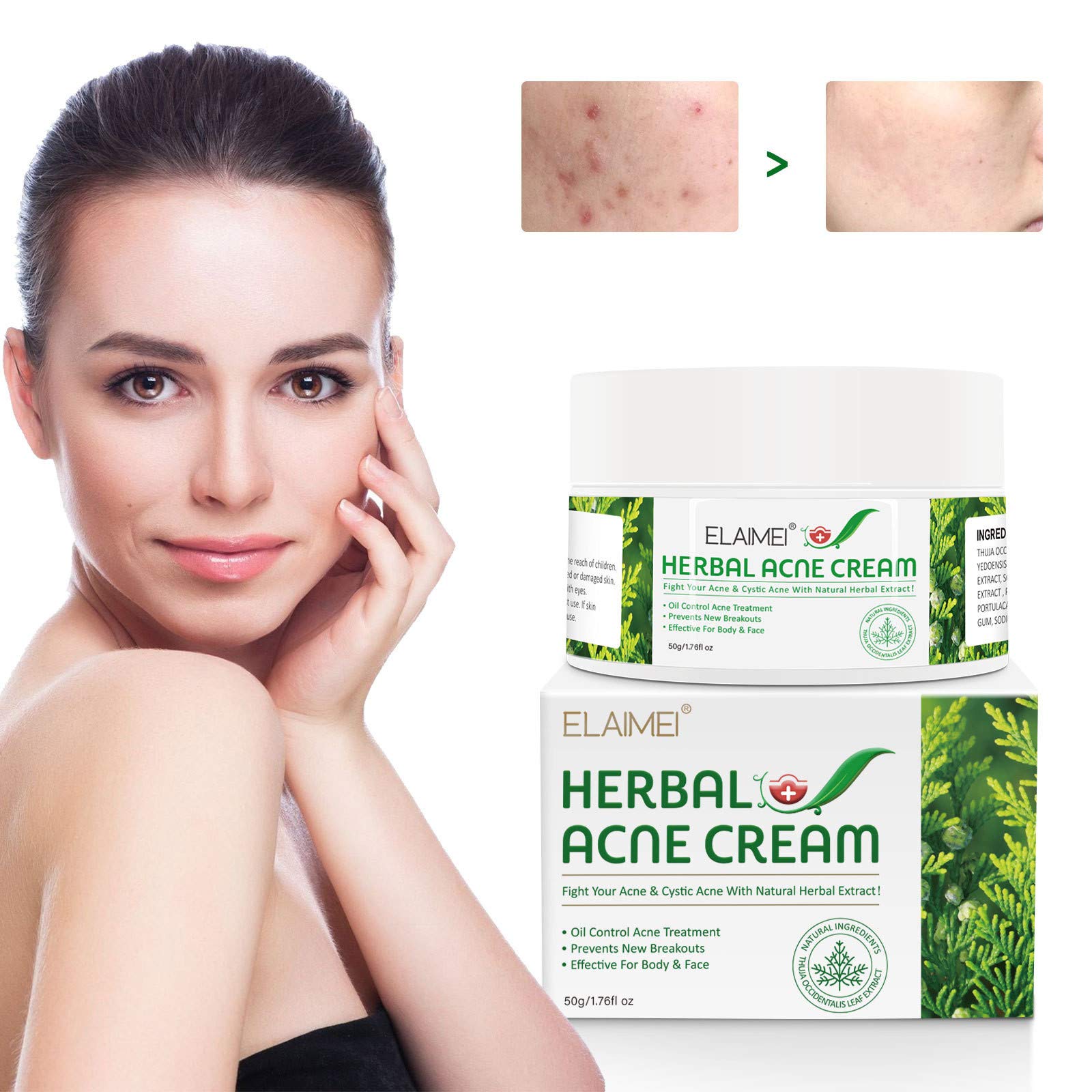 Closed Mouth Improve Herbal Skin Moisturize Personal Skin Care TGw305 (Multicolor, One Size)