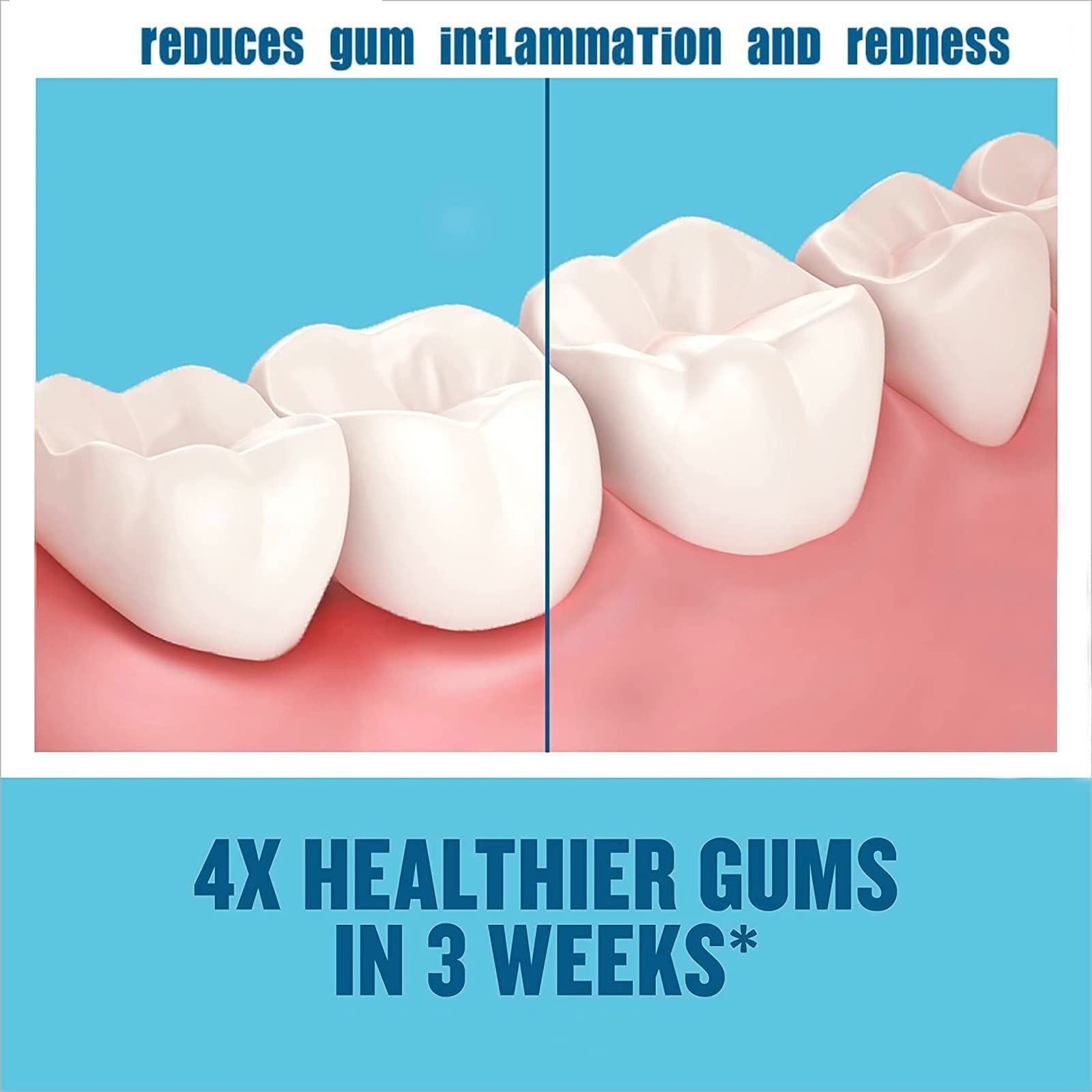 Foam Toothpaste,Whitening Toothpaste,Ultra-fine Mousse Foam Deeply Cleaning Gums,for Deep Cleaning of Gums, Stain Removal & Fresh Breath(2 x 30ml)