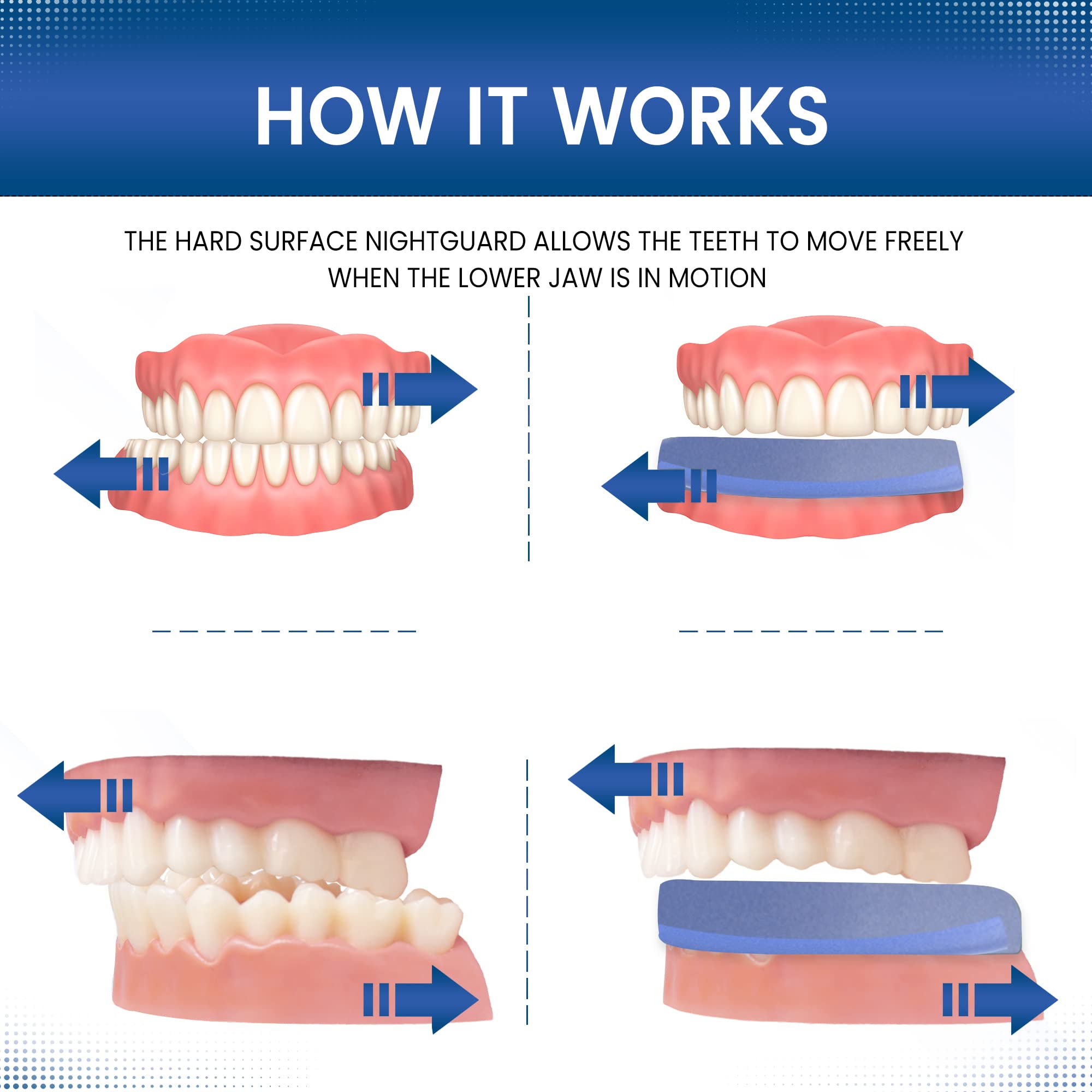 Dental Defense Premium Hard Surface Nightguard