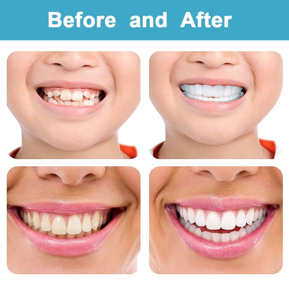 Denture Teeth Temporary Fake Teeth Snap On Top and Bottom Teeth for Men and Women, Cover The Imperfect Teeth,Fix Confident Smile