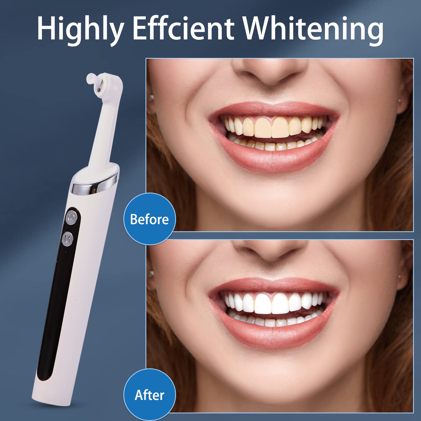 Electric Tooth Polisher, Tooth Whitening Kit for Teeth Whitening and Daily Care Cleaning, USB Rechargeable, Waterproof, Multifunctional Replacement Head (Black)