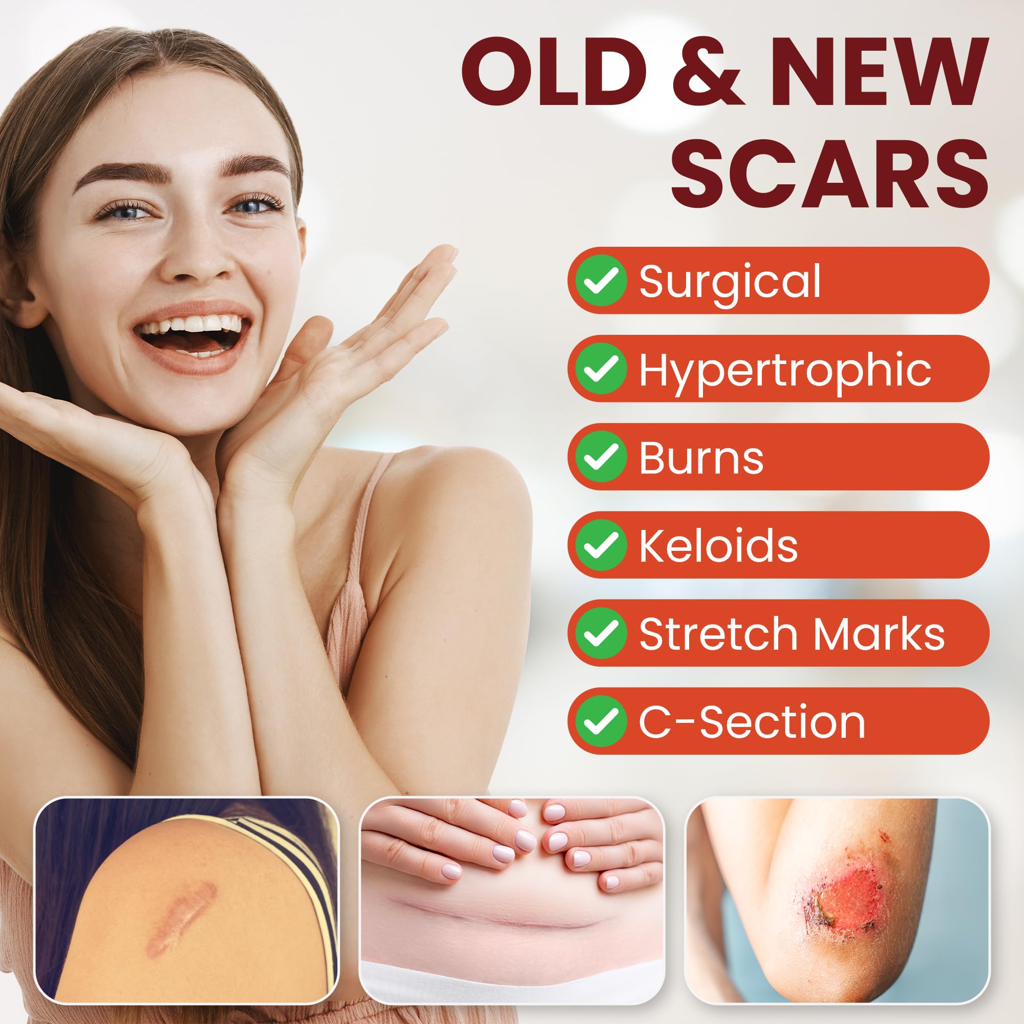 e70 Intensive Healing Scar Cream - Fast Repair Surgical Scars, C-Section, Stretch Marks, Keloids, Burns, Old & New Scars. Vitamins Full - All Skin Types - Reduce Acne Spots Appearance - 2.0 Fl Oz