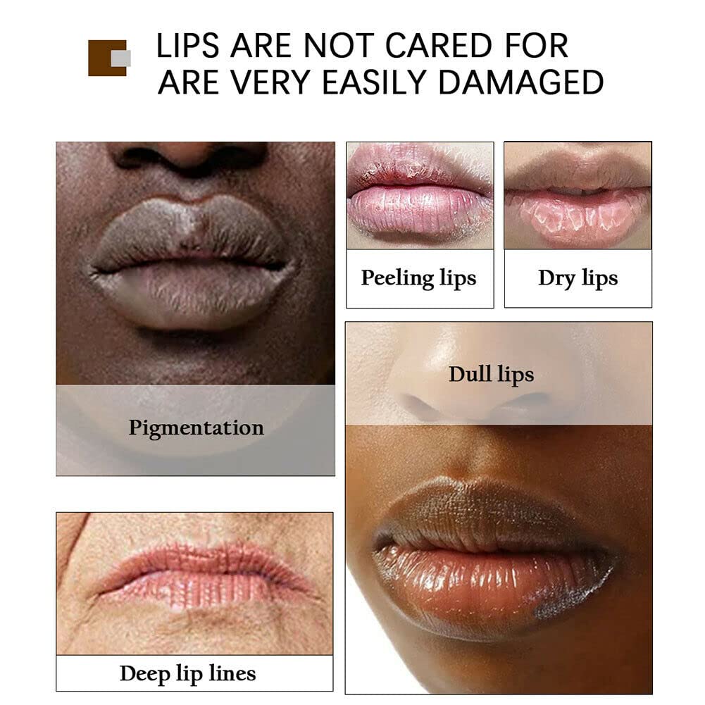 LCMine Lips Pink Fresh Fast Lightening Bleaching Cream Balm Treatment Remove Dark Lips, 0.7 Fl Oz (Pack of 1)