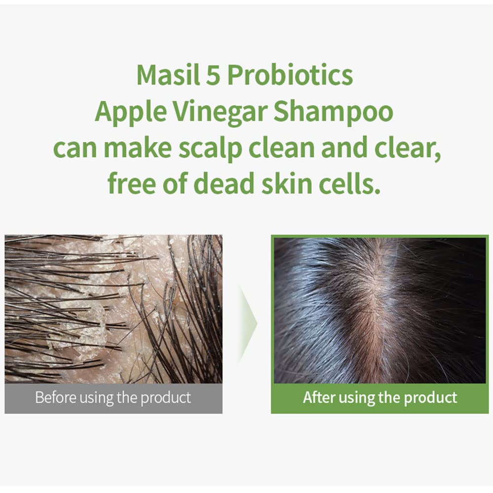 Masil 5 Probiotics Apple Cider Vinegar Shampoo 1Pack(0.3floz X 20ea) Travel Portable Reduces Itchy Scalp Dandruff Frizz Sulfate Free Restores Shine Clarifying Vitamin E Optimal pH level