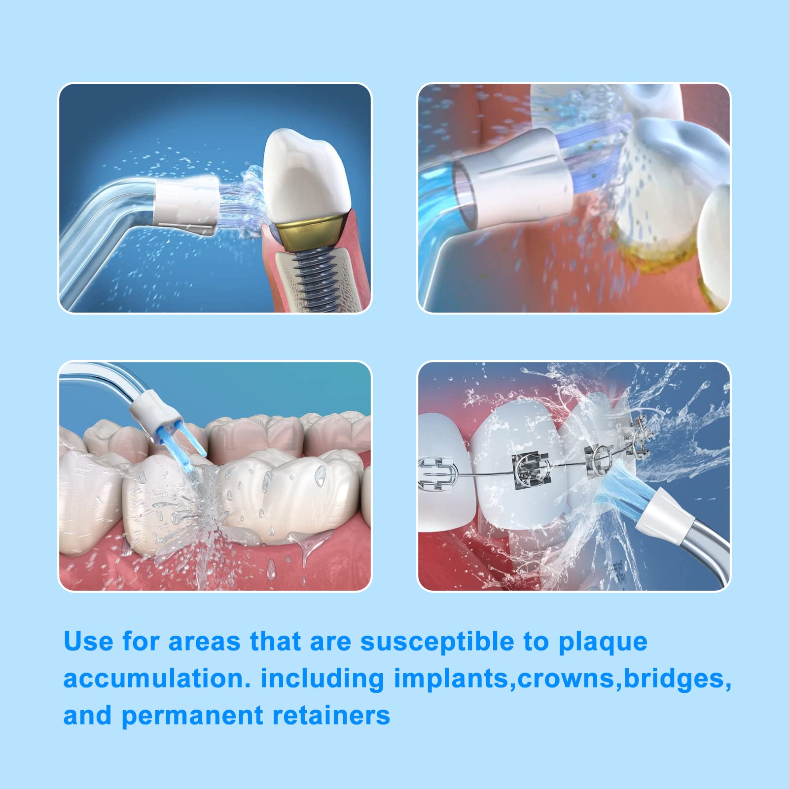 Flosser Replacement Tips for Waterpik Water Flosser,Plaque Seeker Replacement Tips Compatible with Waterpik Water Flossers and Other Brand Oral Irrigators, Plaque Remove Brisles Tips(4-Pack)