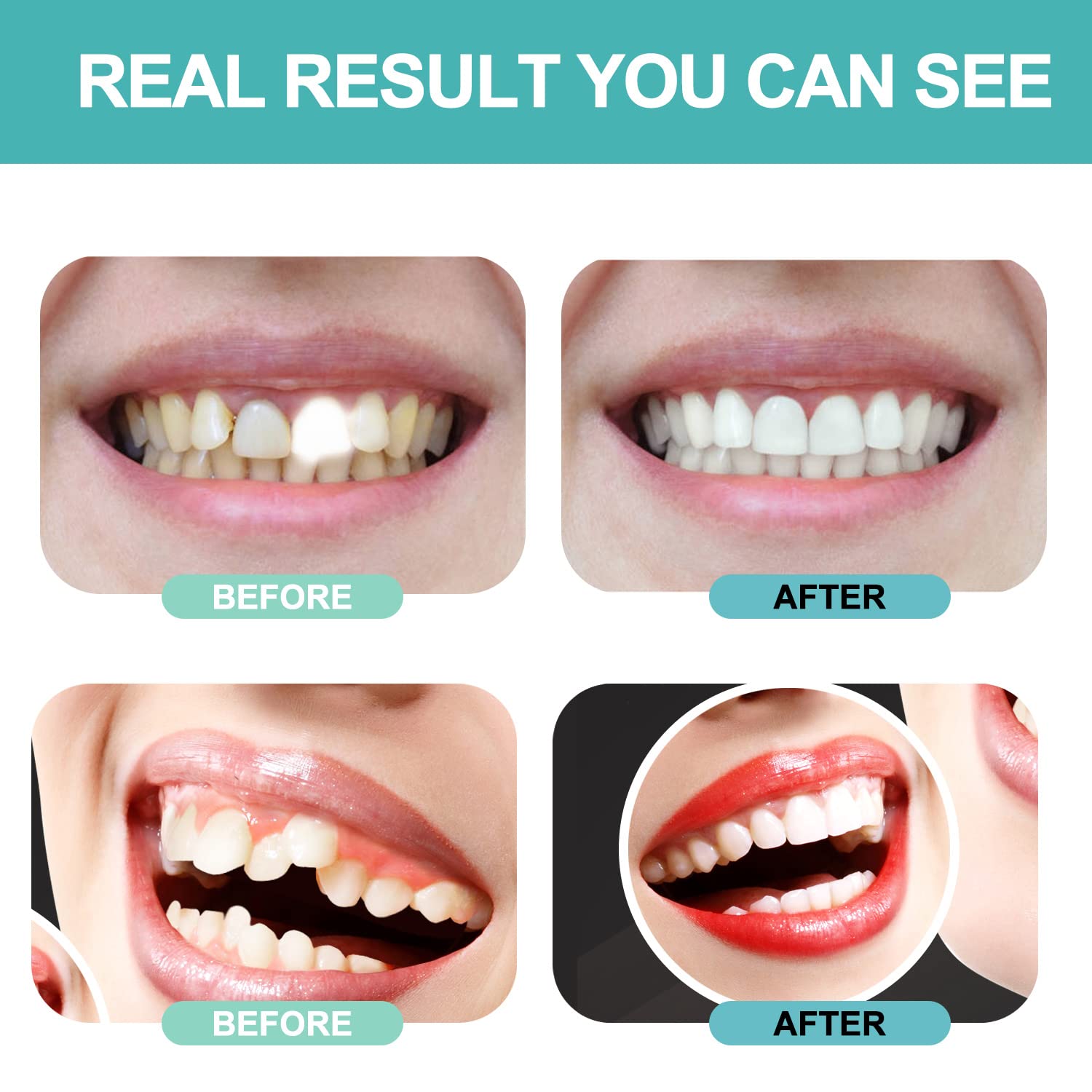 Fake Teeth, Dentures Teeth for Upper and Lower Jaw, Nature and Comfortable, Protect Your Teeth and Regain Confident Smile (1set)
