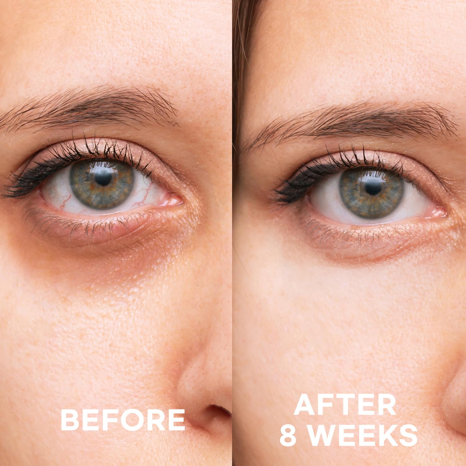 Epielle Firming Eye Cream | Anti-Aging Serum for Sagging Skin and Wrinkles | Cooling Applicator for Refreshing Application | Korean Skincare