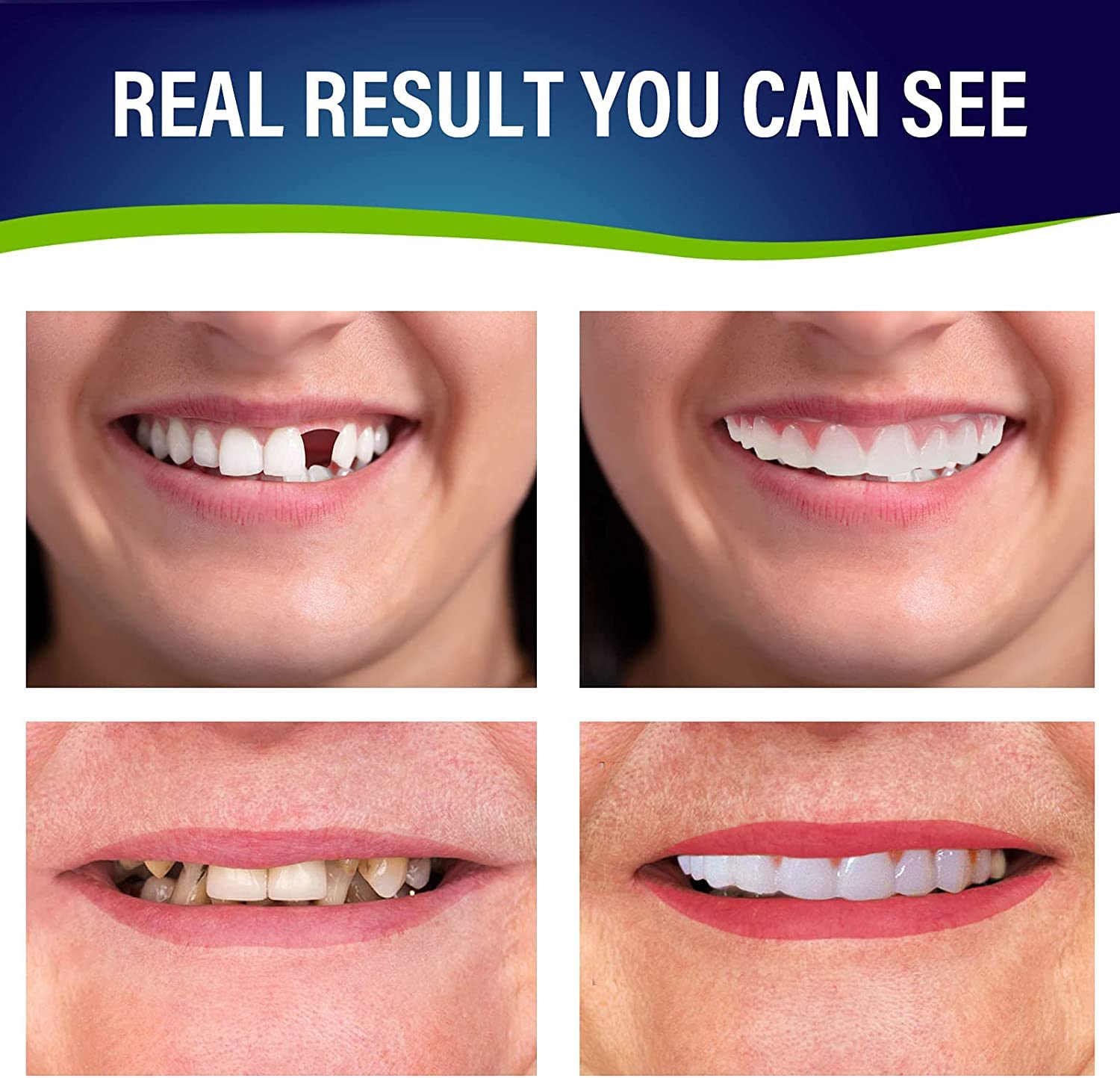 Fake Teeth, Dentures Teeth for Upper Jaw, Nature and Comfortable, Protect Your Teeth, 2 PCS