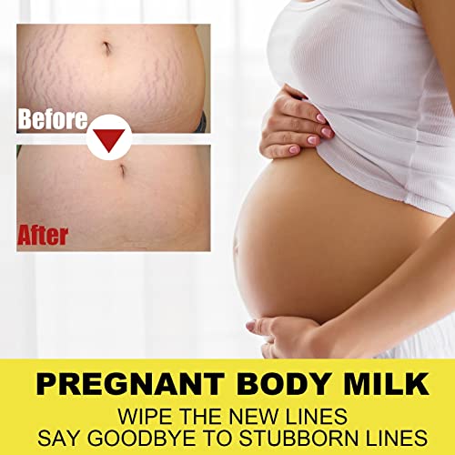 Fix A Plate Stretch Mark For Pregnancy Scar Slack Line Abdomen Stretch Marks Stretch Marks From Pregnancy Scar Slack Line Abdomen Stretch Marks Postpartum Skin Roller