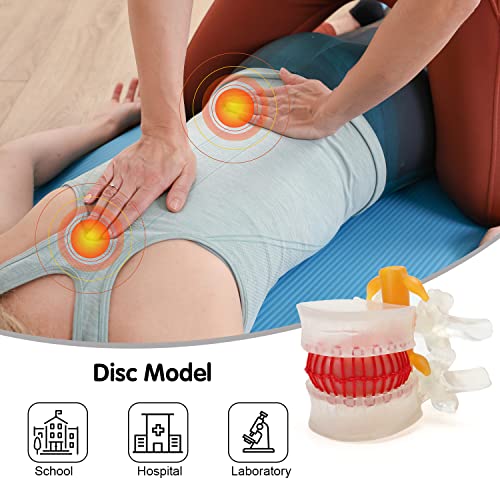 MIIRR Human Lumbar Disc Herniation Model, Transparent Medical Model of Vertebral Spine Anatomy with Elastic Software, Perfect for Learning and Teaching Tool