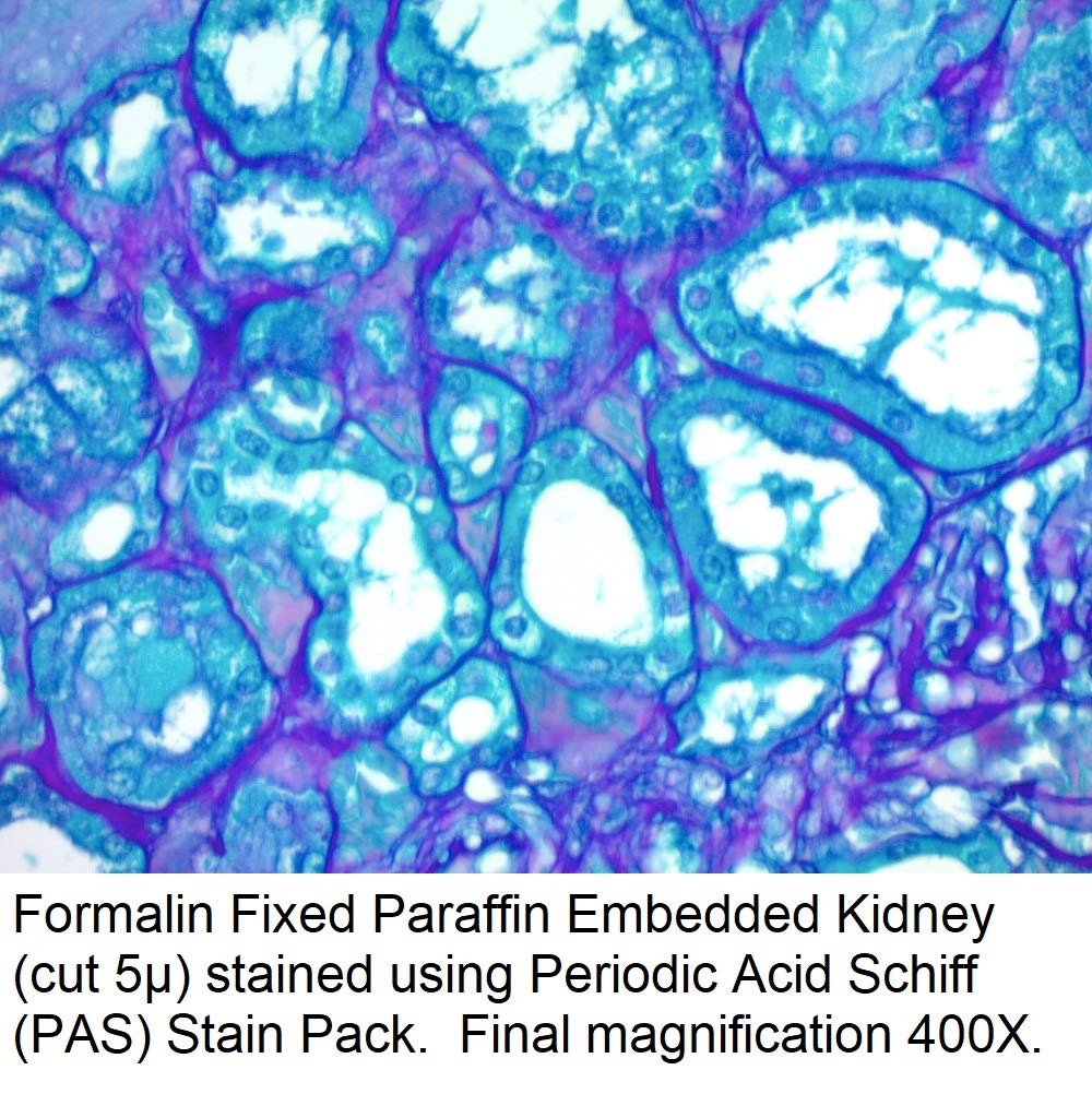 Periodic Acid Schiff (PAS) Stain Pack, 1000ml