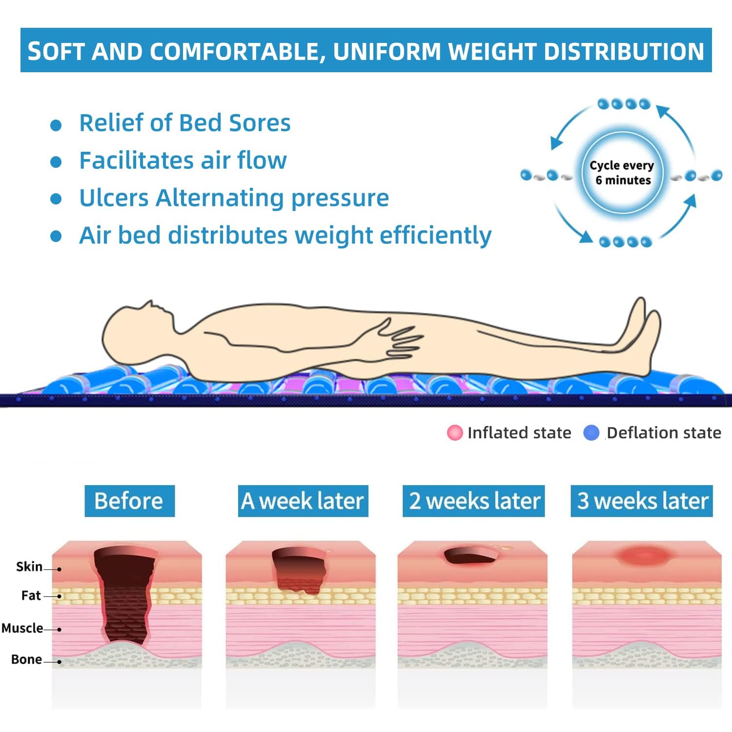 FITCONN Alternating Air Pressure Mattress, 33.5 Inch, Washable, Quiet Pump, Ideal for Bed Sores