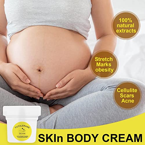 Fix A Plate Stretch Mark For Pregnancy Scar Slack Line Abdomen Stretch Marks Stretch Marks From Pregnancy Scar Slack Line Abdomen Stretch Marks Postpartum Skin Roller
