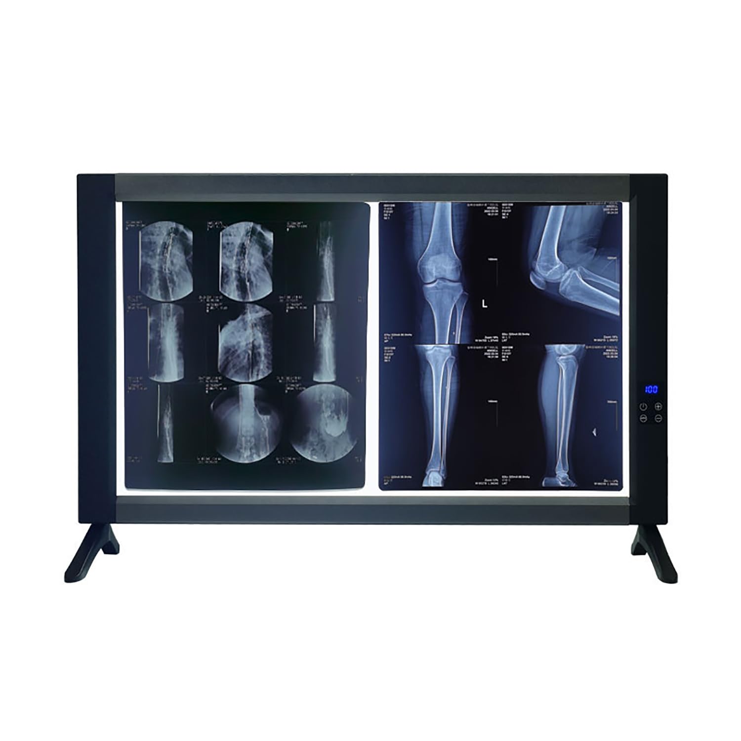 GJLRS X-Ray Film Illuminator Light, Lab Equipment, Box X-ray Viewer Light, LED X-Ray Viewer, Smart Device That Lights Up Immediately After Inserting The X-ray Film, for Clinic Hospital