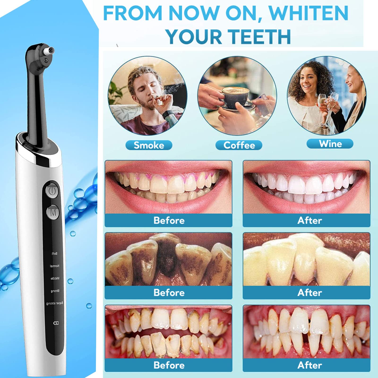 Electric Tooth Polisher, Tooth Whitening Kit for Teeth Whitening and Daily Care Cleaning, USB Rechargeable, Waterproof, Multifunctional Replacement Head (Black)