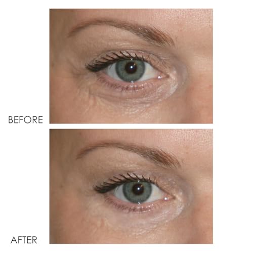 Dermelect Revitalite Professional Eyelid & Dark Circle Corrector for Eyes - Anti Aging Cream with Peptides Brightening & Tightening Treatment for Dark Circles, Puffiness, Droopy Eyelids, Wrinkles