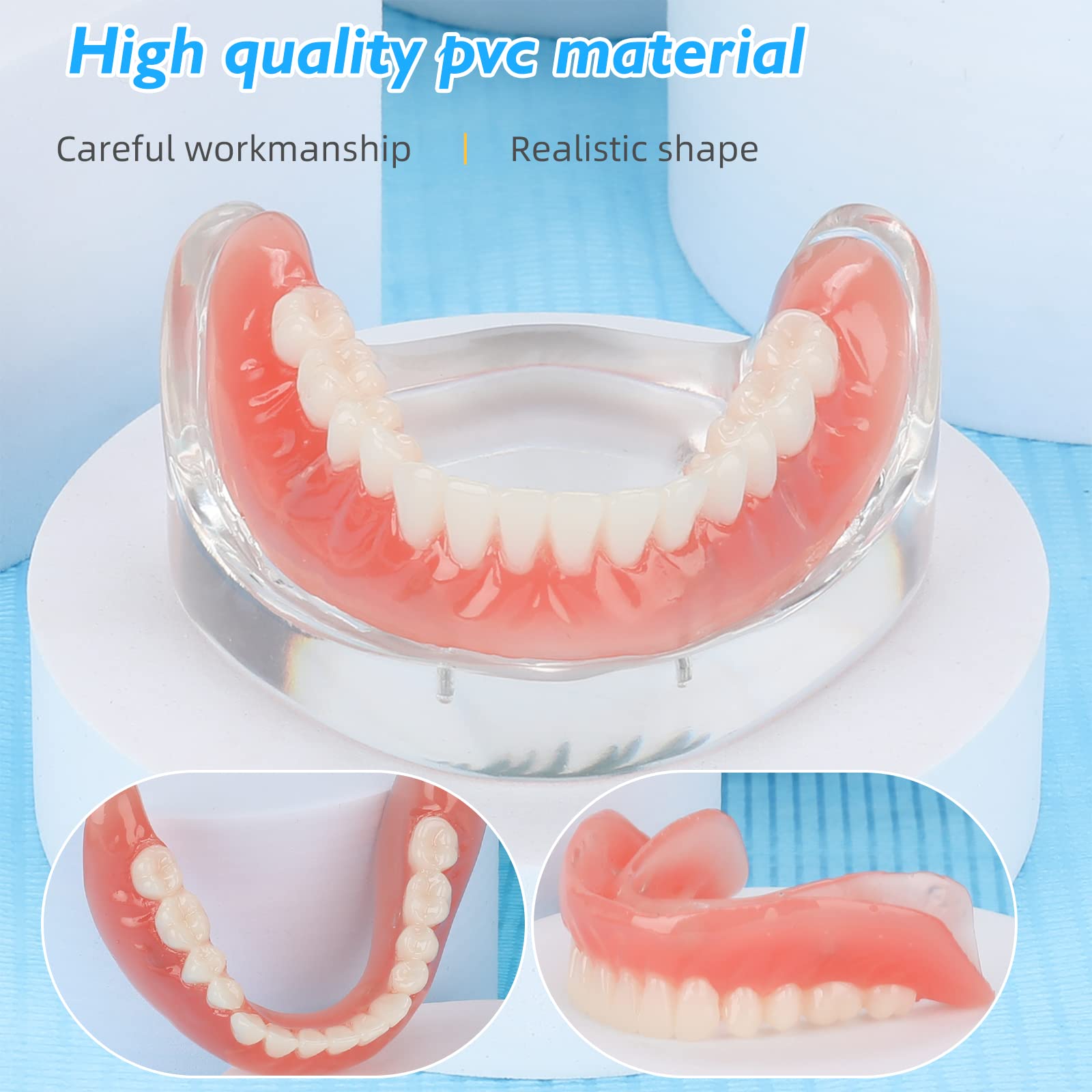 faruijie Overdenture Model - Implant Overdenture Model Lower Denture Model with Four Implants Dental Model Overdenture for Teaching and Studying