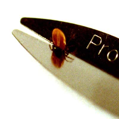 ProTick Remedy 5-Piece Kit (2 Pack) – Precision Steel Tick Remover, 5X Magnifier, Chain, Tick ID Card, Tick ID Information and Protection. Removes All Tick Species and Sizes from Humans and Animals