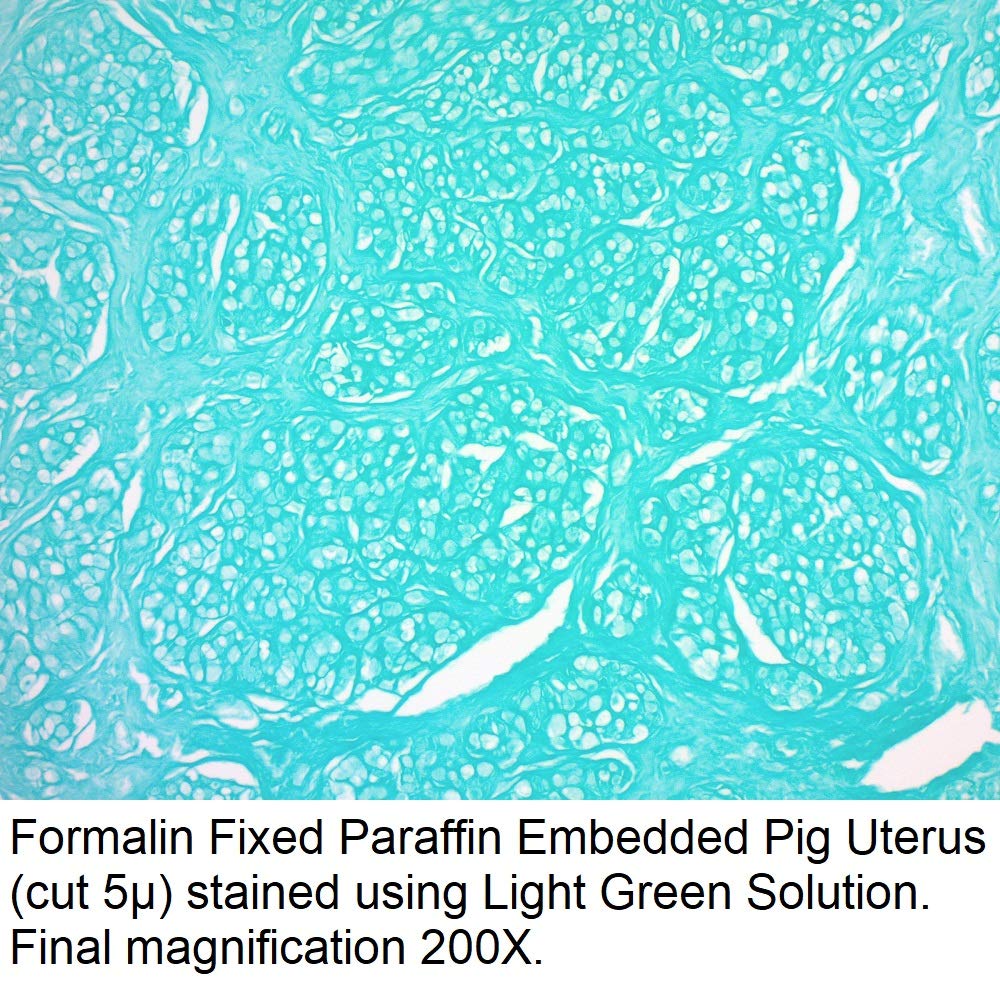 Light Green Solution, 1 Gallon