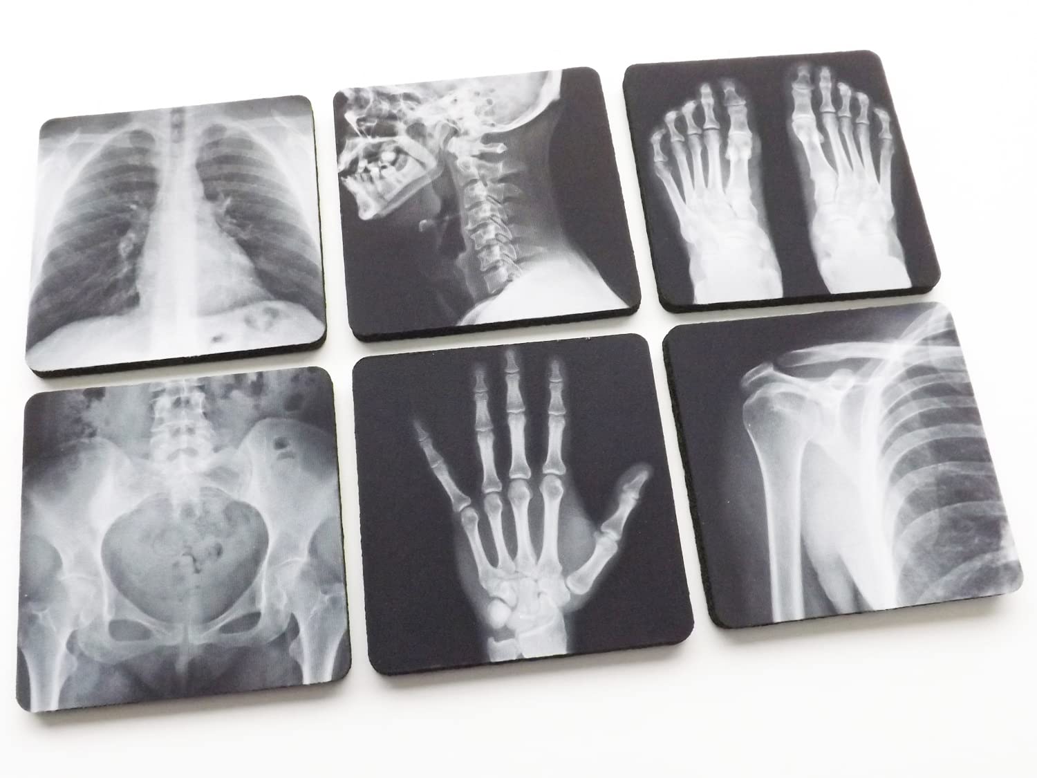 Radiology Drink Coasters Set of 4 or 6 Neoprene or Hardboard Xray Tech Imaging Radiologist Graduation Gift Doctor Nurse