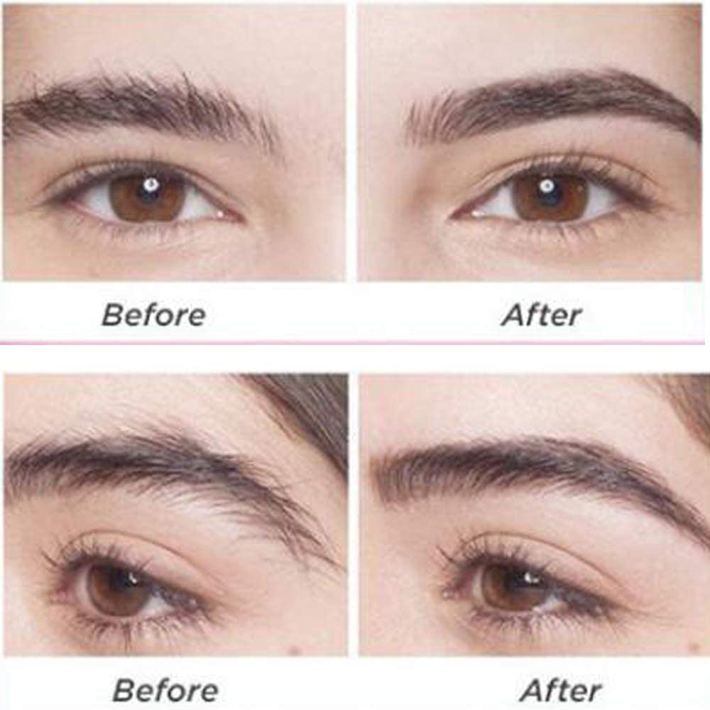 Eyebrow Razor for Women, 5PCS Multipurpose Exfoliating Dermaplaning Tools and Facial Razor with Precision Cover,Safety Beauty Knife for Man and Women