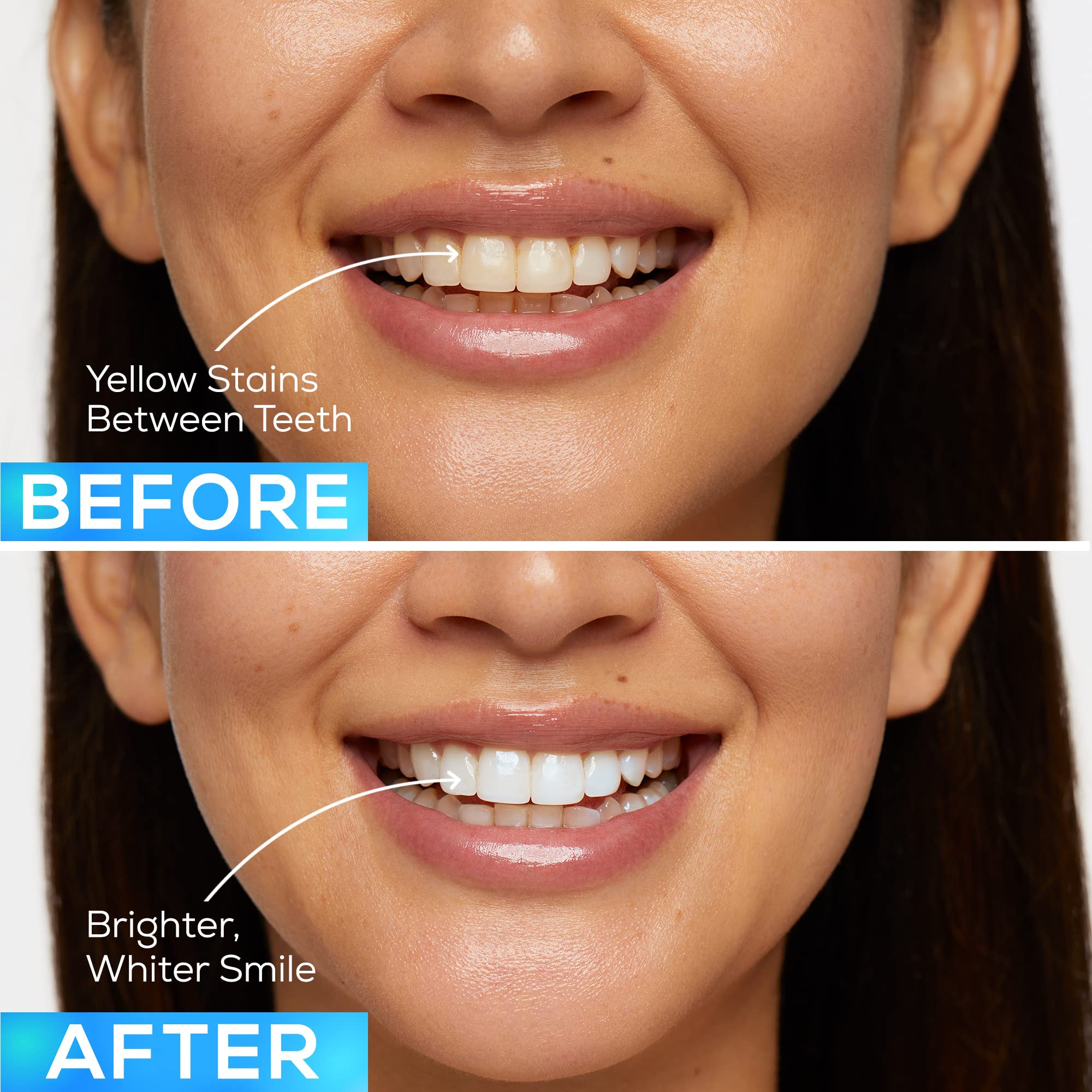 GLO Science Brilliant Teeth Whitening Gel Treatment Kit, 8 Count (Pack of 1)