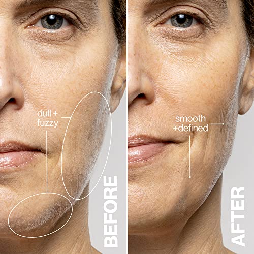 DERMAFLASH LUXE Anti-Aging Sonic Dermaplaning Exfoliation Tool for Women, White