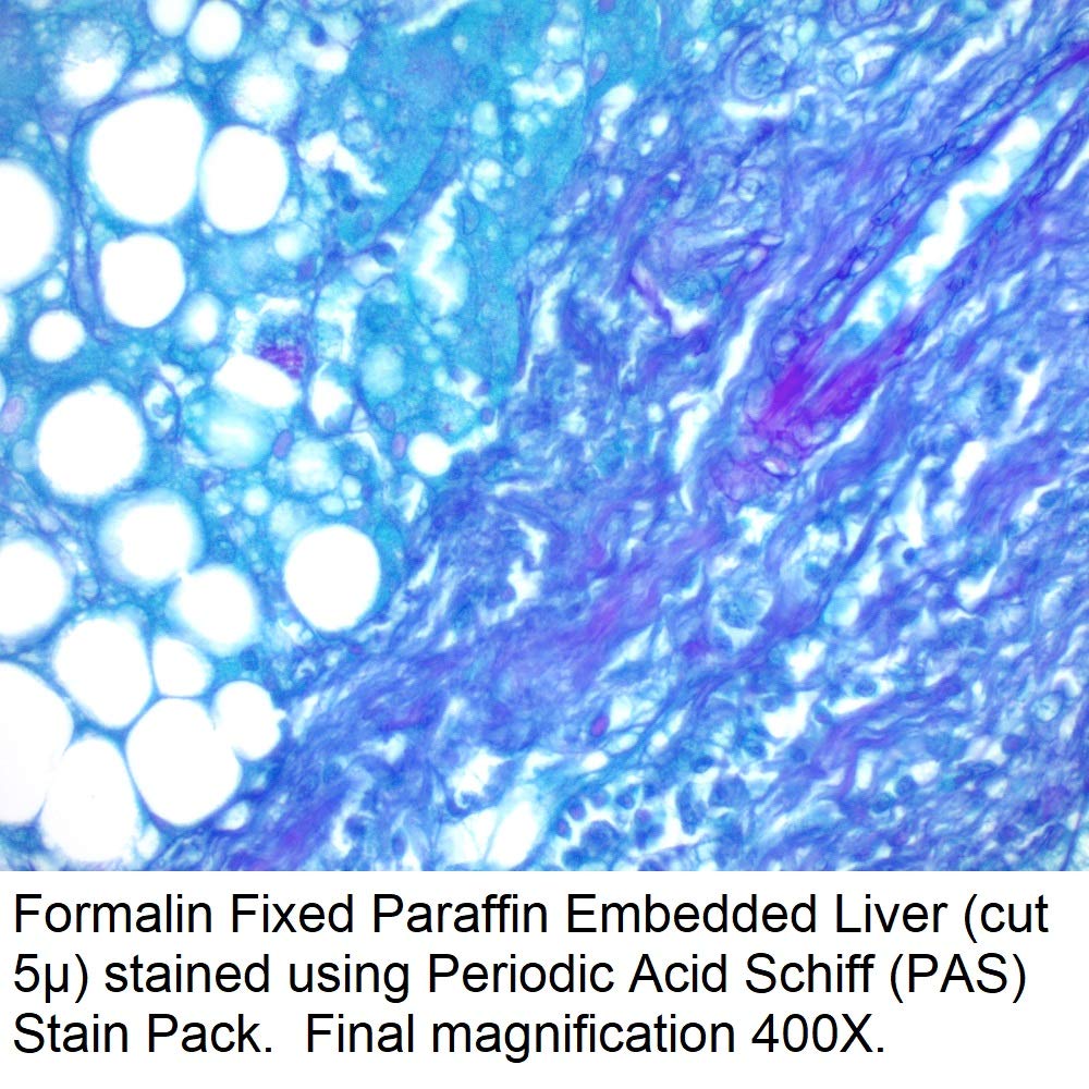Periodic Acid Schiff (PAS) Stain Pack, 1000ml