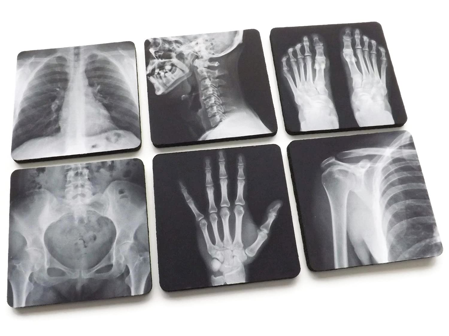 Radiology Drink Coasters Set of 4 or 6 Neoprene or Hardboard Xray Tech Imaging Radiologist Graduation Gift Doctor Nurse